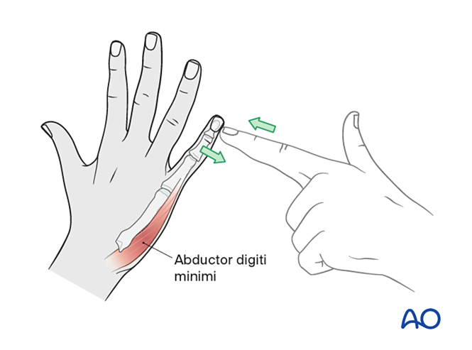 Ulnar And Median Nerve Lesions