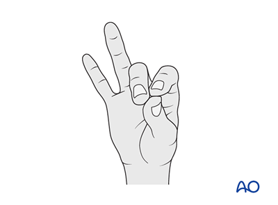 Functional anatomy and biomechanical concepts in the hand