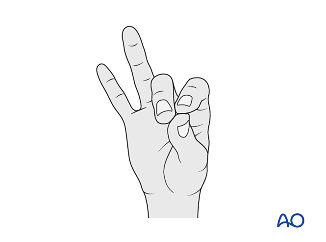 Functional anatomy and biomechanical concepts in the hand