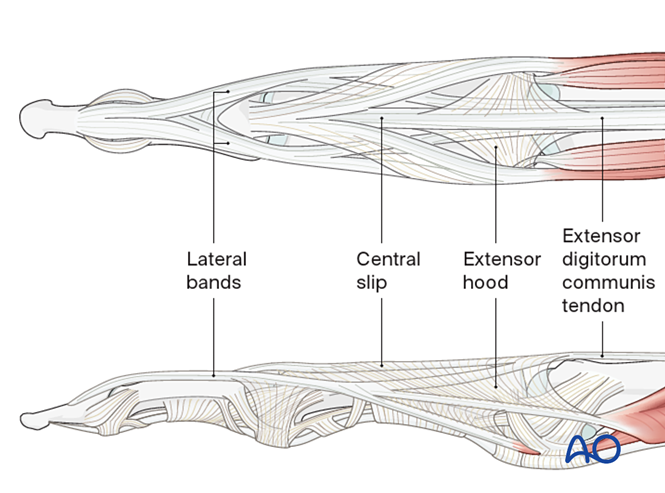 Extensor tendon mechanism