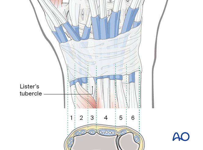 Extensor tendon mechanism