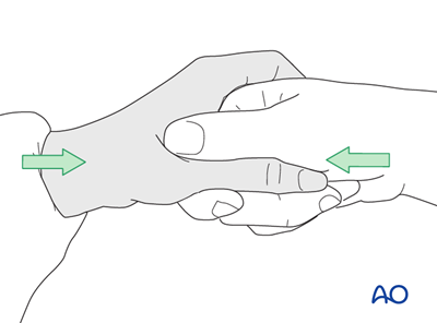 Scaphoid, proximal pole