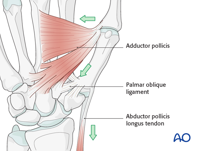 Radiopalmar approach to the base of the thumb