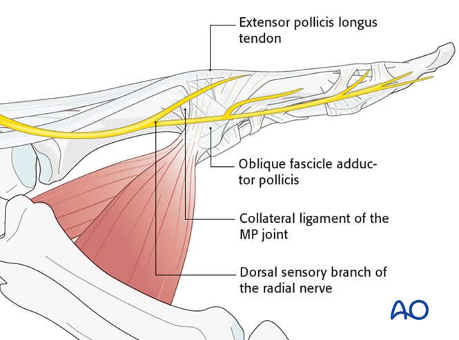 Dorsoulnar approach to the MCP joint of the thumb