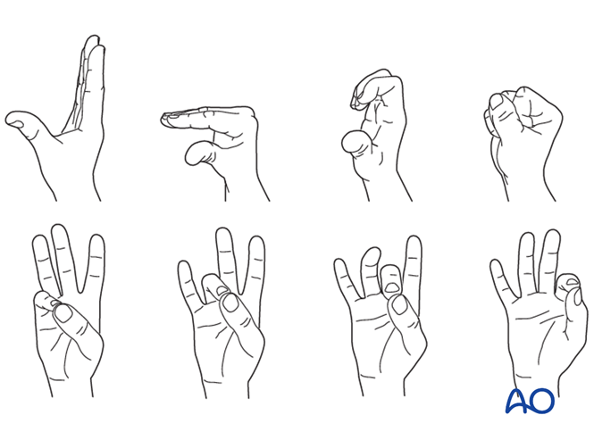 Locking compression plate (LCP) fixation for Metacarpal, base
