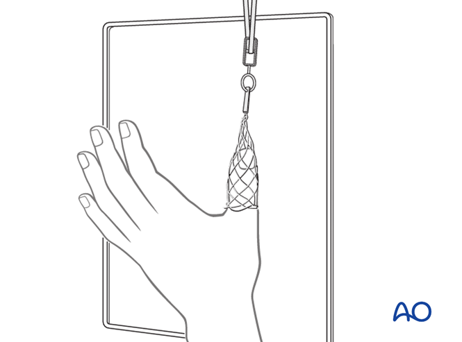 External fixation for Metacarpal, base