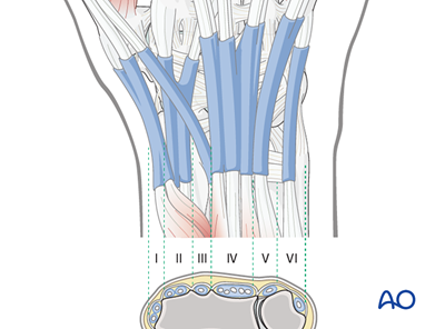 Dorsal approach to the scaphoid