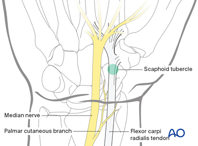 Palmar approach to the scaphoid