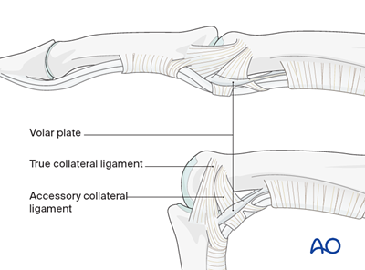 Dorsal approach to the PIP joint