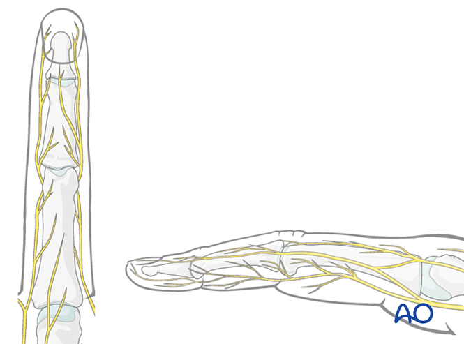 Dorsal approach to the metacarpophalangeal joints