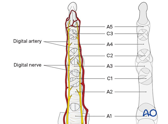 Palmar approach to the proximal interphalangeal joint