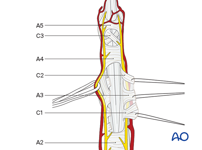 Palmar approach to the proximal interphalangeal joint