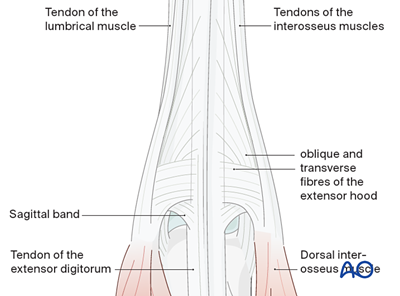 Dorsal approach to the metacarpophalangeal joint