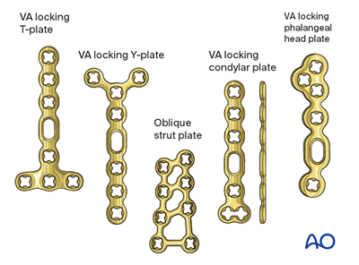 Plating with a lateral plate for Complete articular fracture of the ...