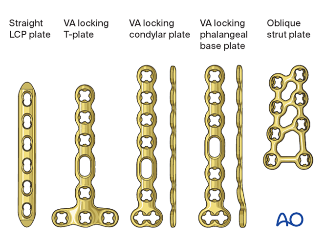Lag-screw and plate fixation for Wedge/multifragmentary fracture of the ...