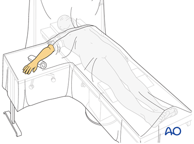 Supine patient position