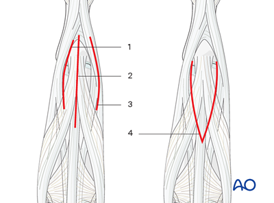 Dorsal approach to the PIP joint