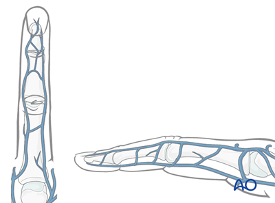 Dorsal approach to the PIP joint