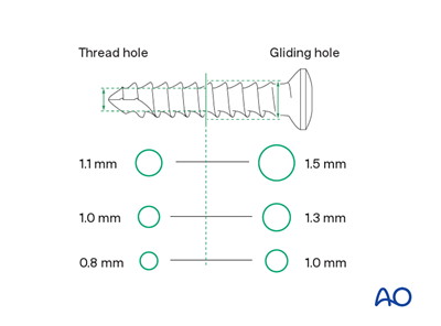 Lag-screw fixation for Oblique extraarticular or diaphyseal fracture