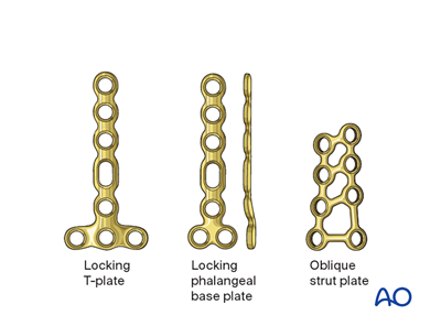 Lag-screw and plate fixation for Multifragmentary extraarticular or ...