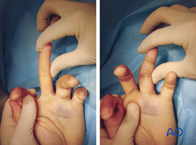 Patient assessment