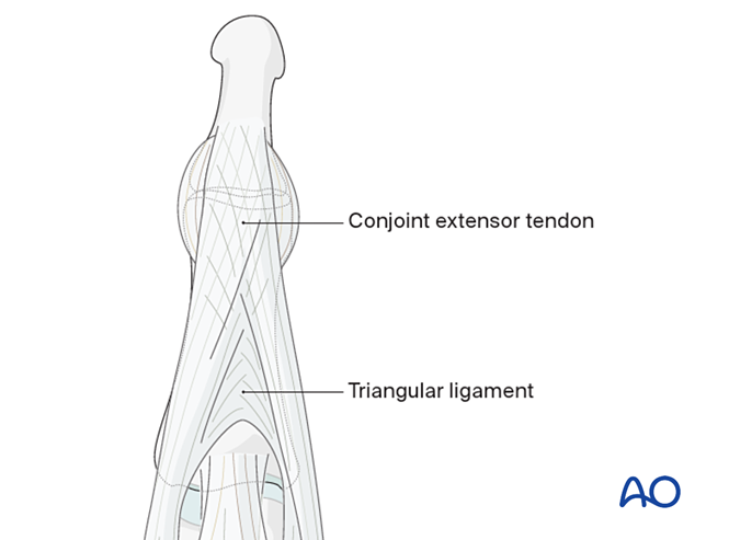 Extensor tendon mechanism
