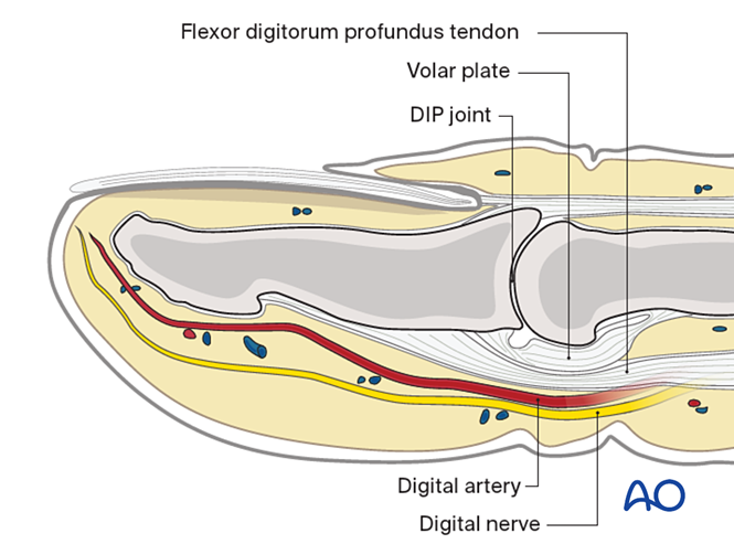 Palmar approach to the DIP joint