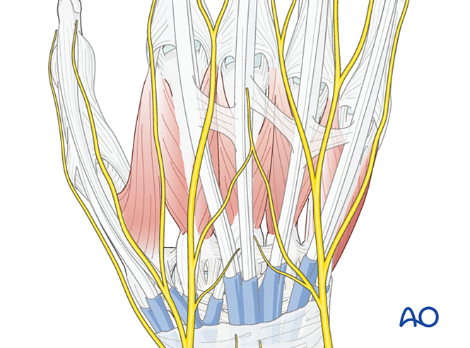 Dorsal approach to the metacarpals