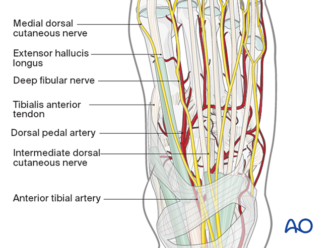 Percutaneous approach to the navicular