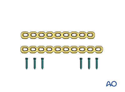 Plate fixation for Multifragmentary cuboid fracture