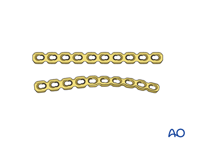 Plate fixation for Multifragmentary cuboid fracture