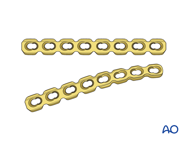 Plate fixation for Cuneiform fracture