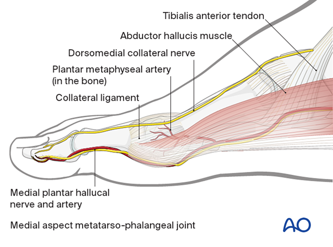 Medial approach to the hallux