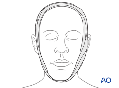 Transoral approach to the angle