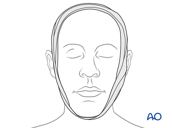 Transoral approach to the angle