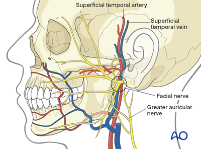Retromandibular approaches