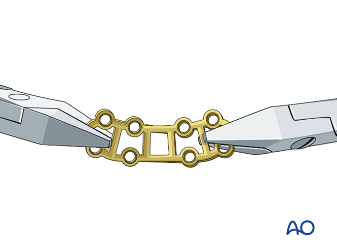 ORIF, strut plate for Angle - simple