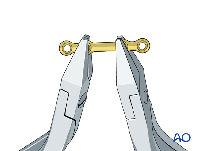 ORIF, one load sharing plate for Angle - simple