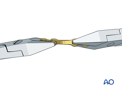 ORIF, one load sharing plate for Angle - simple