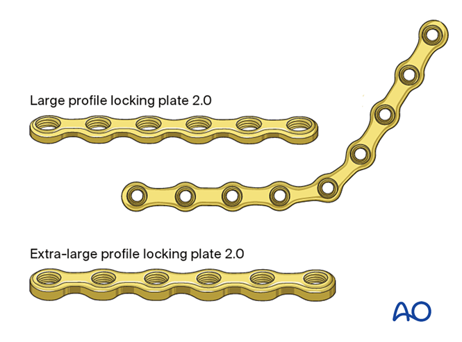 ORIF, two load sharing plates for Angle - complex