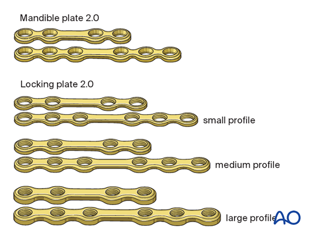 ORIF, one/two plate(s) - endoscopically assisted for Condylar process ...