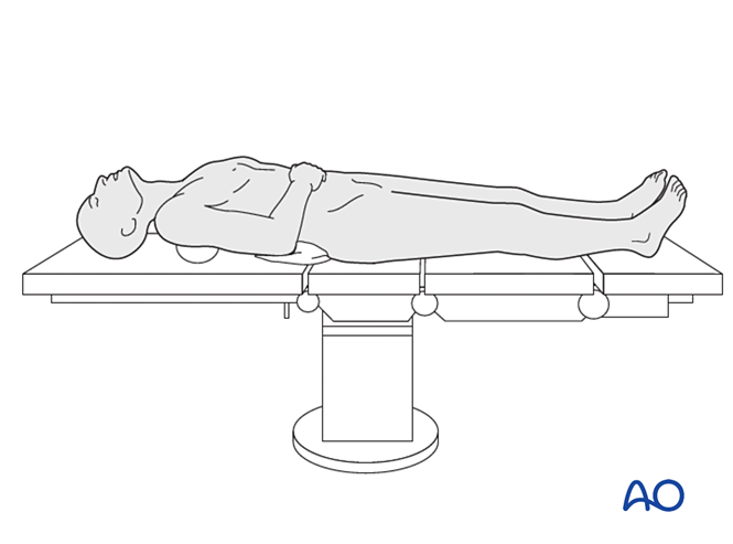 ORIF, arch bar and load-sharing plate for Symphysis and parasymphysis ...