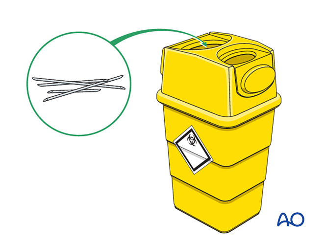 Interdental wires (embrasure)