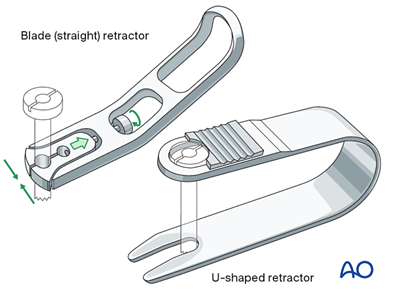 90 X020 transbuccal system new
