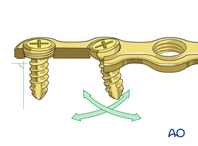 Screw insertion into locking plates