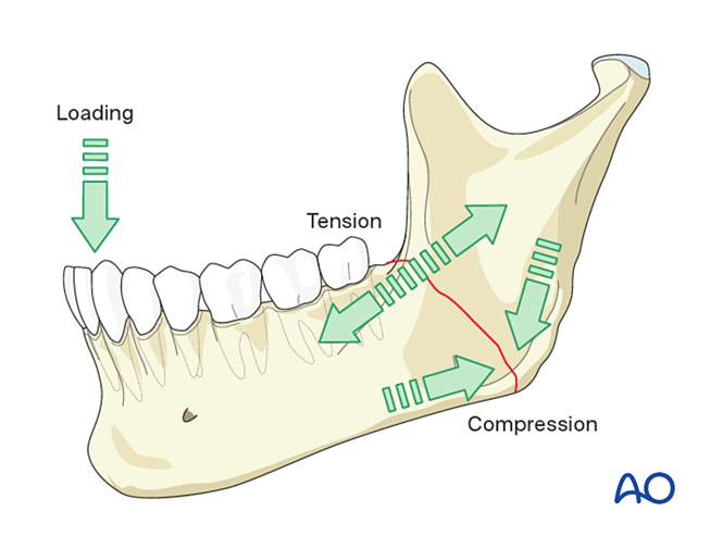 90 X072 Biomechanics of the mandible