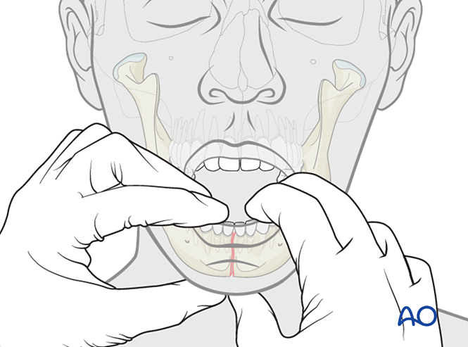Examination of patients with mandibular fractures