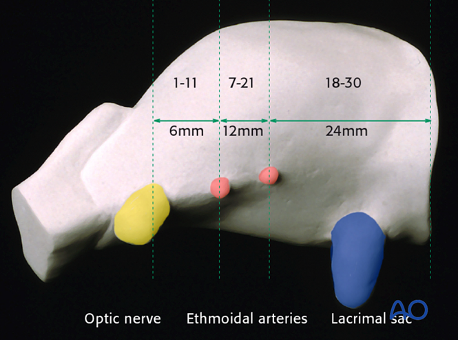 Periorbital dissection - Introduction