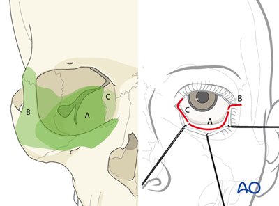 Periorbital dissection - Introduction