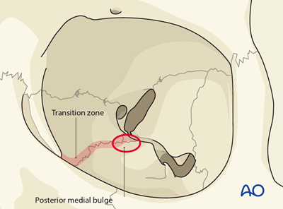 Bony anatomy of the orbit